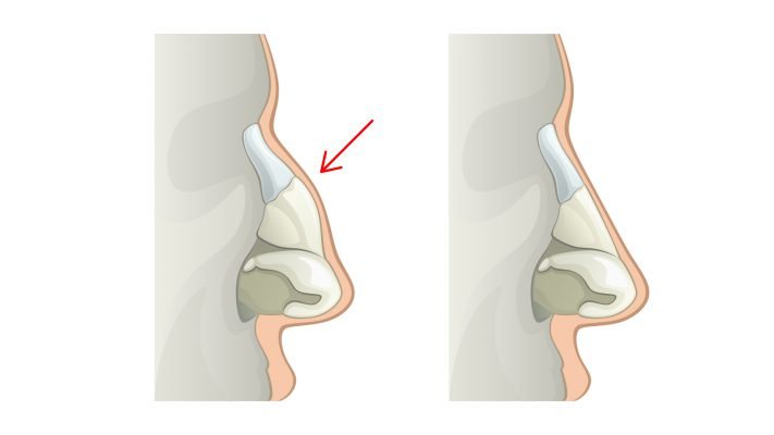 Lesson 13 I How to Draw a Nose - Lillian Gray - Art School